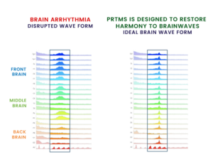 PrTMS - Certus Psychiatry & Integrated Care